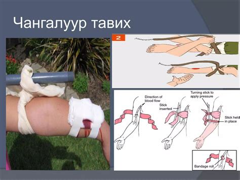 цус алдалтыг тогтоох Pptx