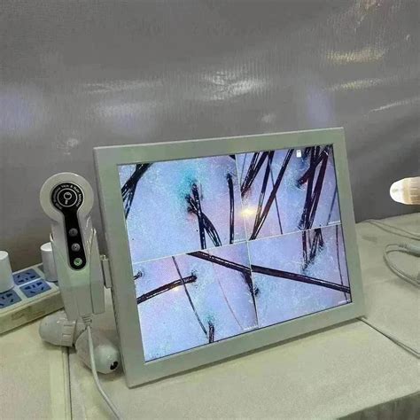 Professional Scalp Analyzer Discover Scalp Health Luxe Beauty And Body Co