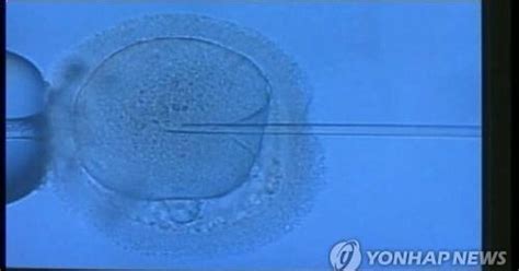 유전질환 해소 기대 세부모 체외수정 기술적 결함