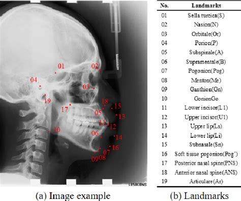 Figure 2 From An Automatic Cephalometric Landmark Detection Method Based On Heatmap Regression