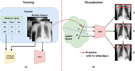 Visualizing Chest X Ray Dataset Biases Using Gans