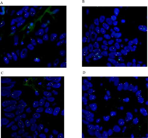 Figure 2 From A Robust Fish Assay To Detect Fgfr2 Translocations In