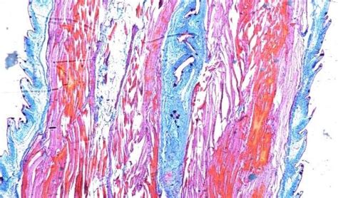 Cross Section Of Lizard Tail That Has Undergone Autotomy 4x10 Download Scientific Diagram