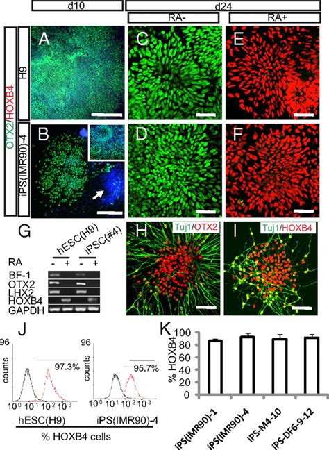 Neural Differentiation Of Human Induced Pluripotent Stem Cells Follows