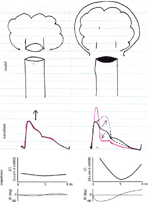 The New Methods Arise From Analysis Of Pressure And Flow Waveforms In