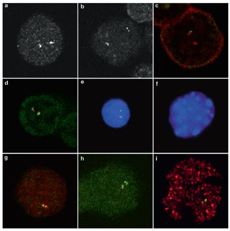 Nascent RNA FISH Service Creative Bioarray
