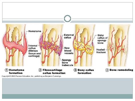 Skeletal System Notespart 2 Bone Formation Ossification The