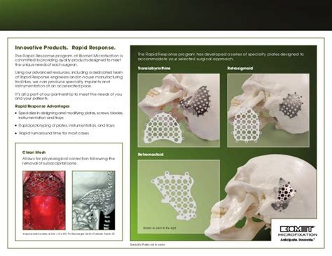Neuro Lorenz Plating System