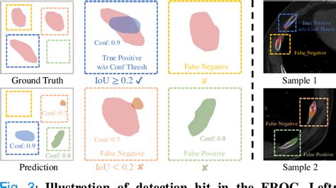 Figure 3 From Deep Rib Fracture Instance Segmentation And