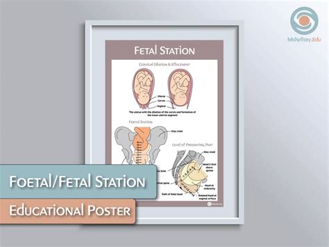 Foetalfetal Station Educational Poster Etsy