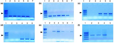 Pcr Agarose Gel 1Á5 Images From Clostridium Difficile Field Isolates Download Scientific