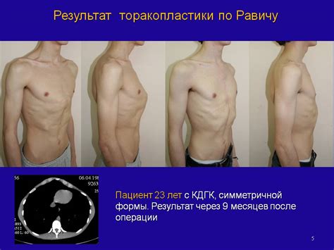 Thorax Титульная страница Презентация доклада Хирургическое