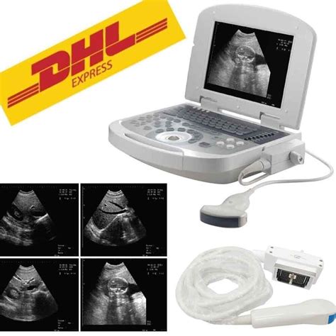 Handheld Digital Ultrasound Machine Medical Convex Probe Micro Convex Probe Ultrasound