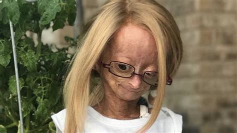 Adalia Rose Clips Famous Birthdays