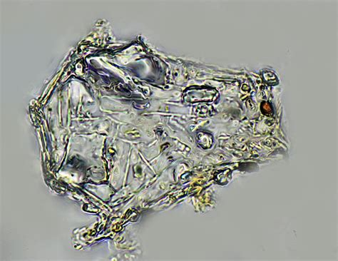 Das Mosaiktierchen Difflugia Mikroskopie Das Deutschsprachige Mikroskopie Forum