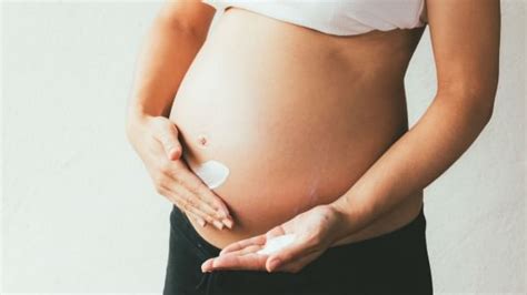 How To Prevent Stretch Marks