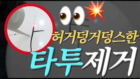 타투제거 어떻게 하는 게 좋을까🧐 I 풍선도 터지지 않는 안전함 직접 확인해보세요👀 I 타투 계의 💎슈퍼카 간접 체험