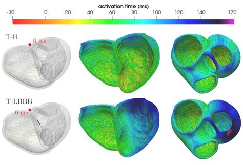 New Mox Report On “coupled Eikonal Problems To Model Cardiac Reentries In Purkinje Network And