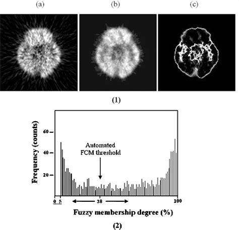Figure 2 From Real Time Volume Rendering Visualization Of Dual Modality