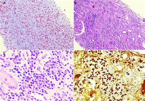 Plasma Cell Histology