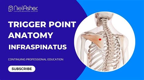 Exploring The Infraspinatus Understanding Trigger Point Locations For Better Muscle Health