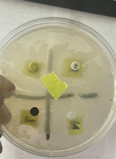 Disk Diffusion Fail R Medlabprofessionals