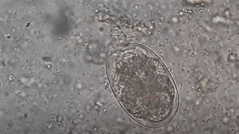 Clinically Important Parasites Introductioncommon And Scientific