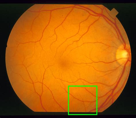 Retinal Vessel Segmentation Results On Three Publicly Available Download Scientific Diagram