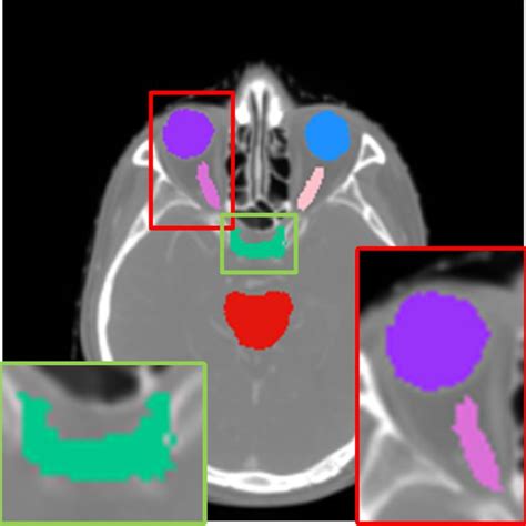Some Segmentation Examples Of Comparative Experiment Gt Is Ground