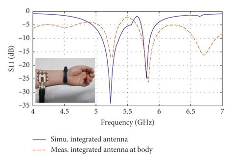 S11 Of The Integrated Mss Antenna At Human Tissues Download Scientific Diagram