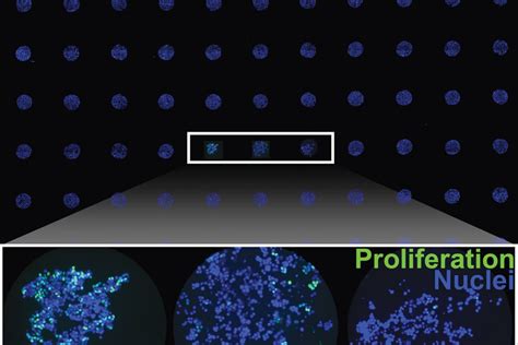 Microarray Makes Chemo Personal