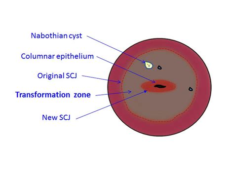 Cervix Anatomy Transformation Zone