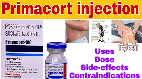 Hydrocortisone Injection Primacort Injection Uses Dose Side Effects Cort S Injection Youtube