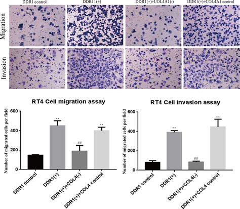 Cell Migration And Invasion After Ddr1 Overexpression And Col4a1