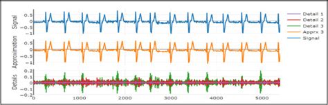 an efficient ecg signals denoising technique based on the combination