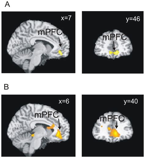 A Neural Responses To Increasing Social Exclusion In The Mpfc Of