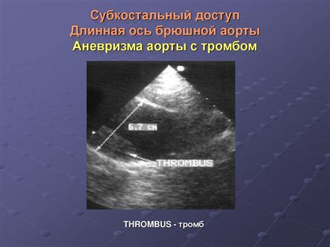 Эхокардиография режимы области применения презентация онлайн