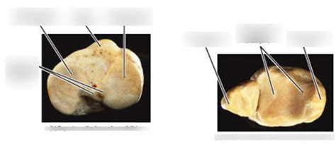 Superior And Inferior Articular Surface Of Tibia And Fibula Diagram Quizlet