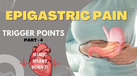 Epigastric Pain Trigger Point Series Part 4 Trigger Point
