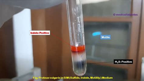 SIM Test For Bacteria Archives Medical Notes