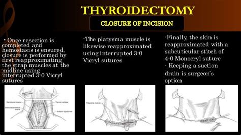 Thyroidectomy Operative Surgery