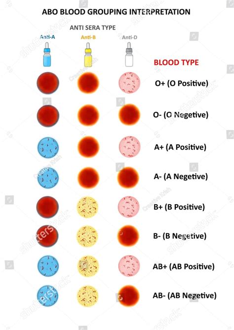 Blood Type Test Kit Dischem At Mary Wilber Blog