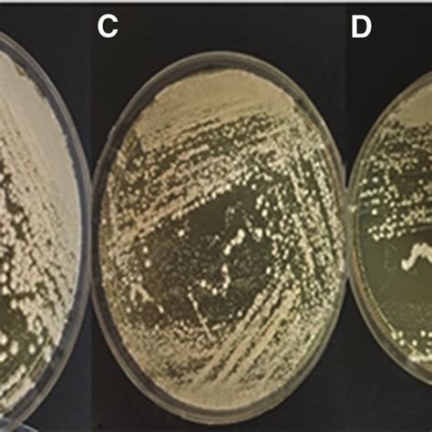Sugar Concentrations Of The Fermentation Broth Including Five Different Download Scientific