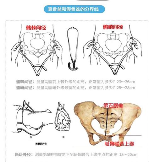 测量骨盆演示图图解 骨盆尺寸怎么测量图片 骨盆测量 第7页 大山谷图库