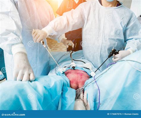 Process Of Gynecological Surgery Operation Using Laparoscopic Equipment