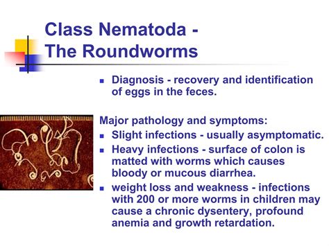 Nematodes Pptx Infectious Diseases Diseases And Conditions