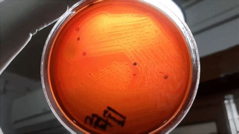 L Pyrrolidinyl β Naphthylamide Pyr Test Introduction Principle
