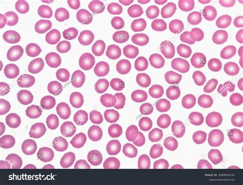 Globulos Over 3 Royalty Free Licensable Stock Illustrations And Drawings