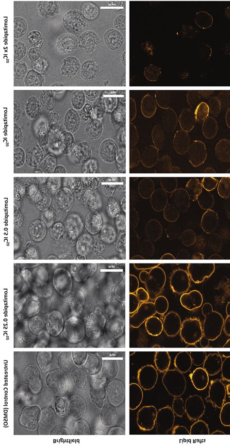 Detection Of Lipid Raft Microdomain Arrangements In Nci H929 Cells Download Scientific Diagram