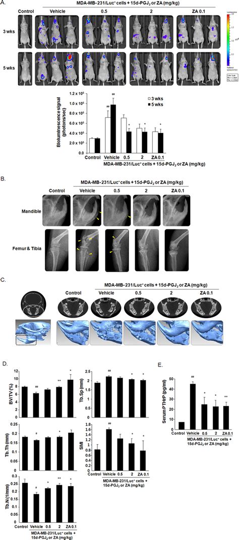 Effect Of 15d Pgj2 On Osteolytic Bone Metastasis In Nude Mice That Download Scientific Diagram